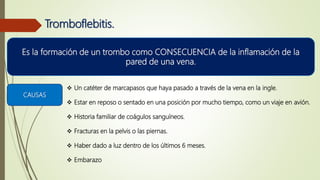 Tromboflebitis y flebotrombosis | PPTX