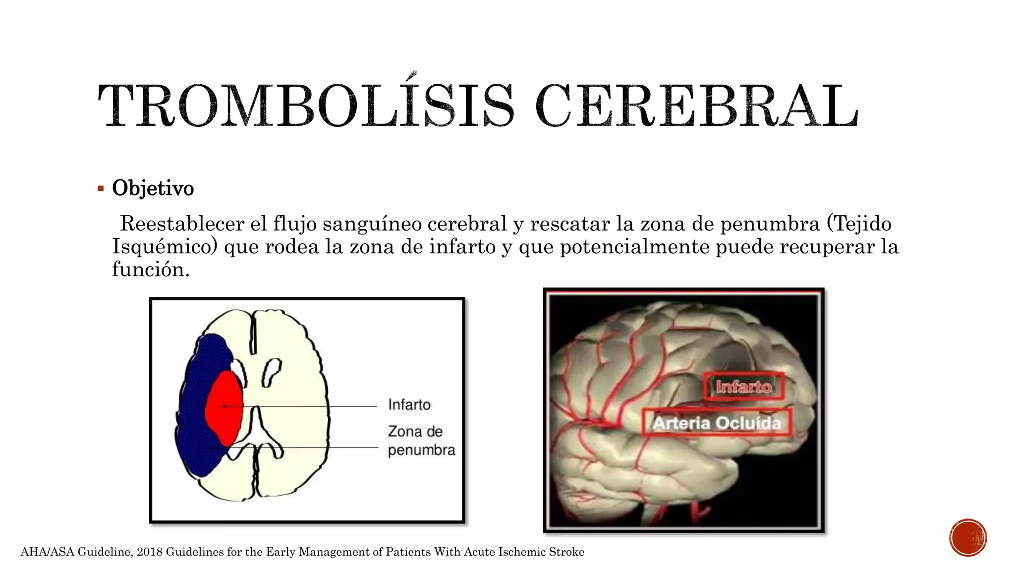 TROMBOLISIS.pptx