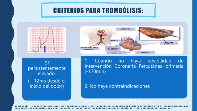 trombolisis en infarto agudo al miocardio | PPTX