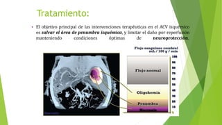 trombolisis en acv isquemico agudo.pptx