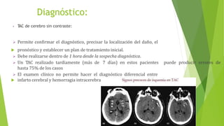 trombolisis en acv isquemico agudo.pptx