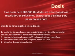 Trombolisis en Paciente con IAM | PPTX