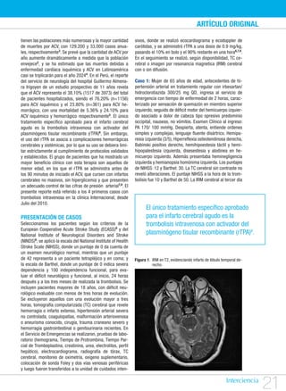 Primeros casos del manejo agudo con trombolisis endovenosa del ...