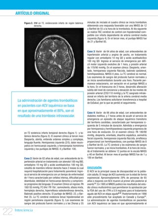 Primeros casos del manejo agudo con trombolisis endovenosa del ...