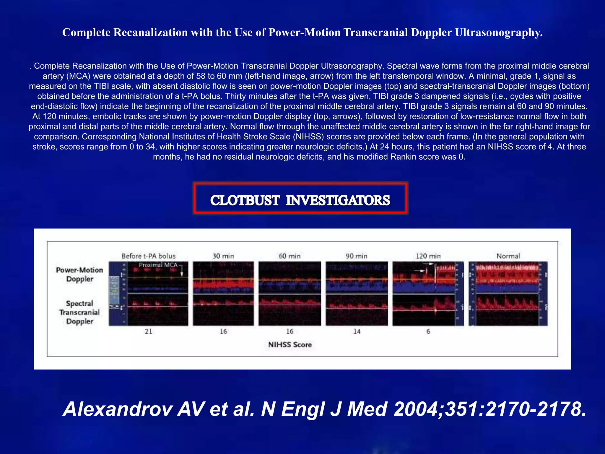 TROMBOLISIS INTRA-ARTERIAL EN EVENTO CEREBRAL VASCULAR ISQUEMICO AGUDO ...