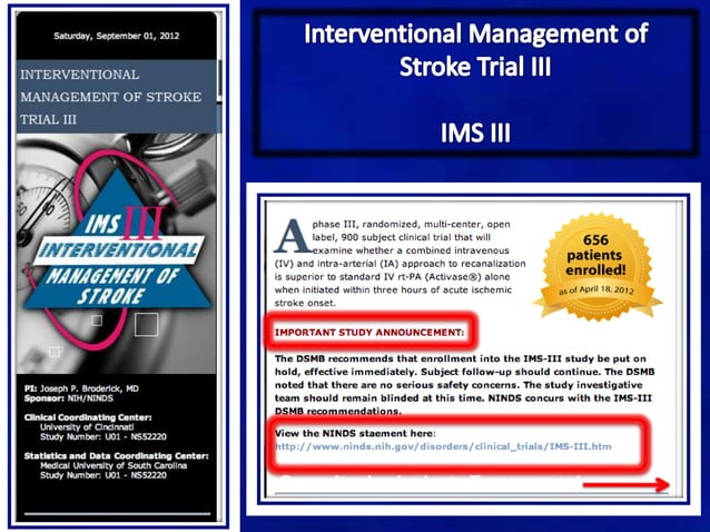 TROMBOLISIS INTRA-ARTERIAL EN EVENTO CEREBRAL VASCULAR ISQUEMICO AGUDO ...