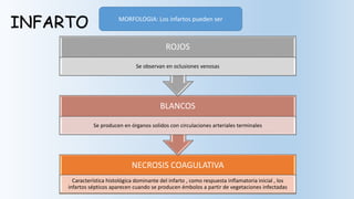 trombo shock.ppt
