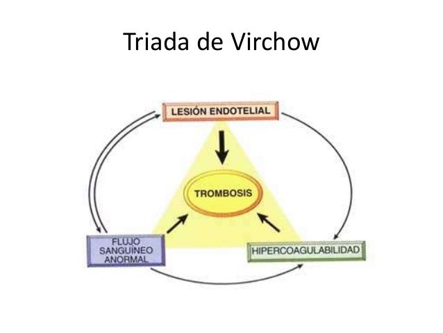 Trombosis