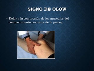 trombosis-venosa-profunda.pptx