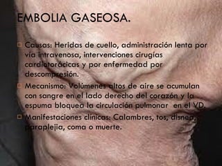 Trombosis, embolia e infarto | PPT