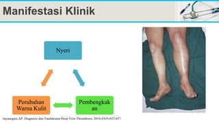 Deep Vein Trombosis | PPTX