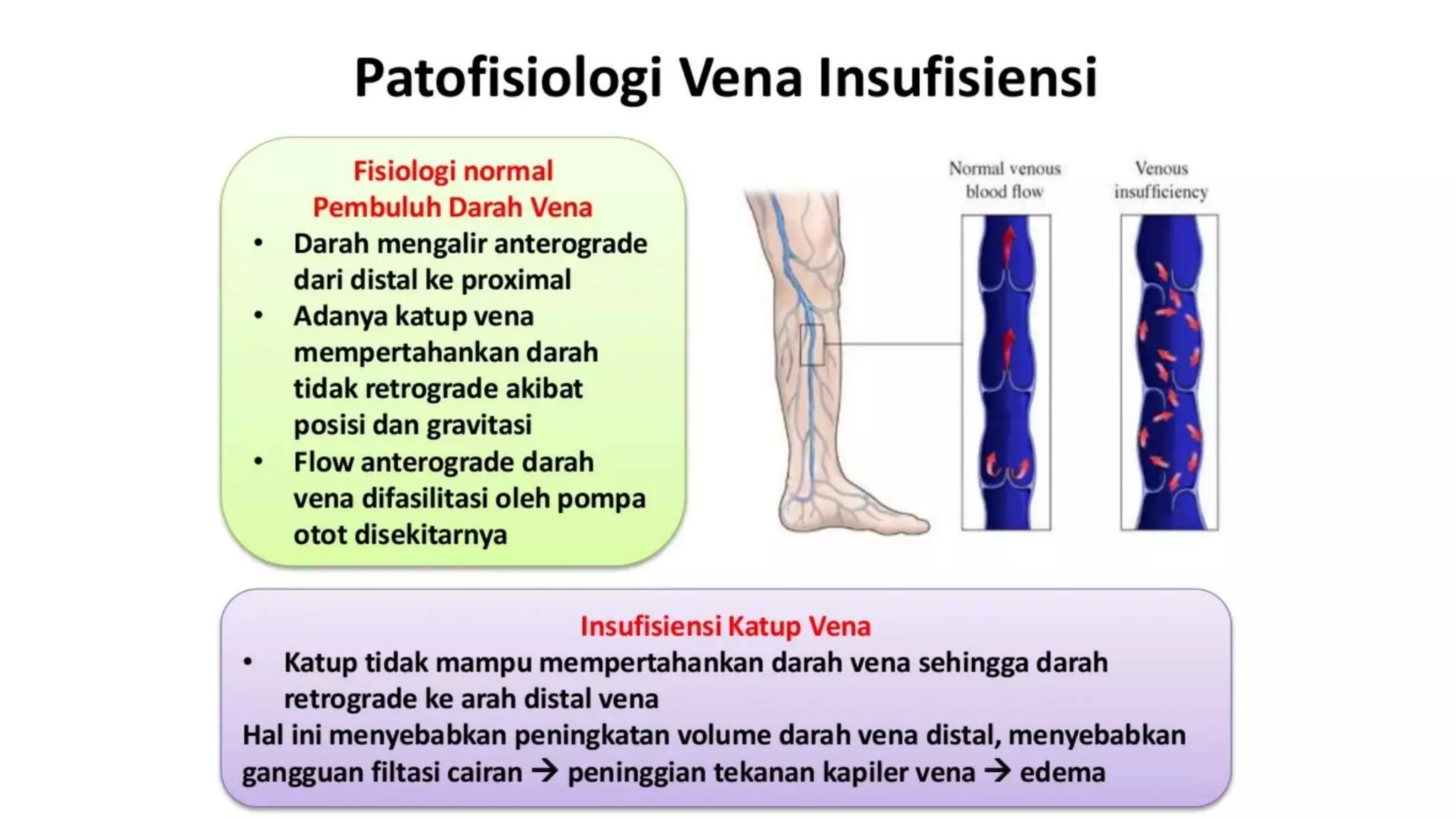 TROMBOSIS VENA DALAM DAN VARISES VENA DALAM.pptx | Blood Disorders ...