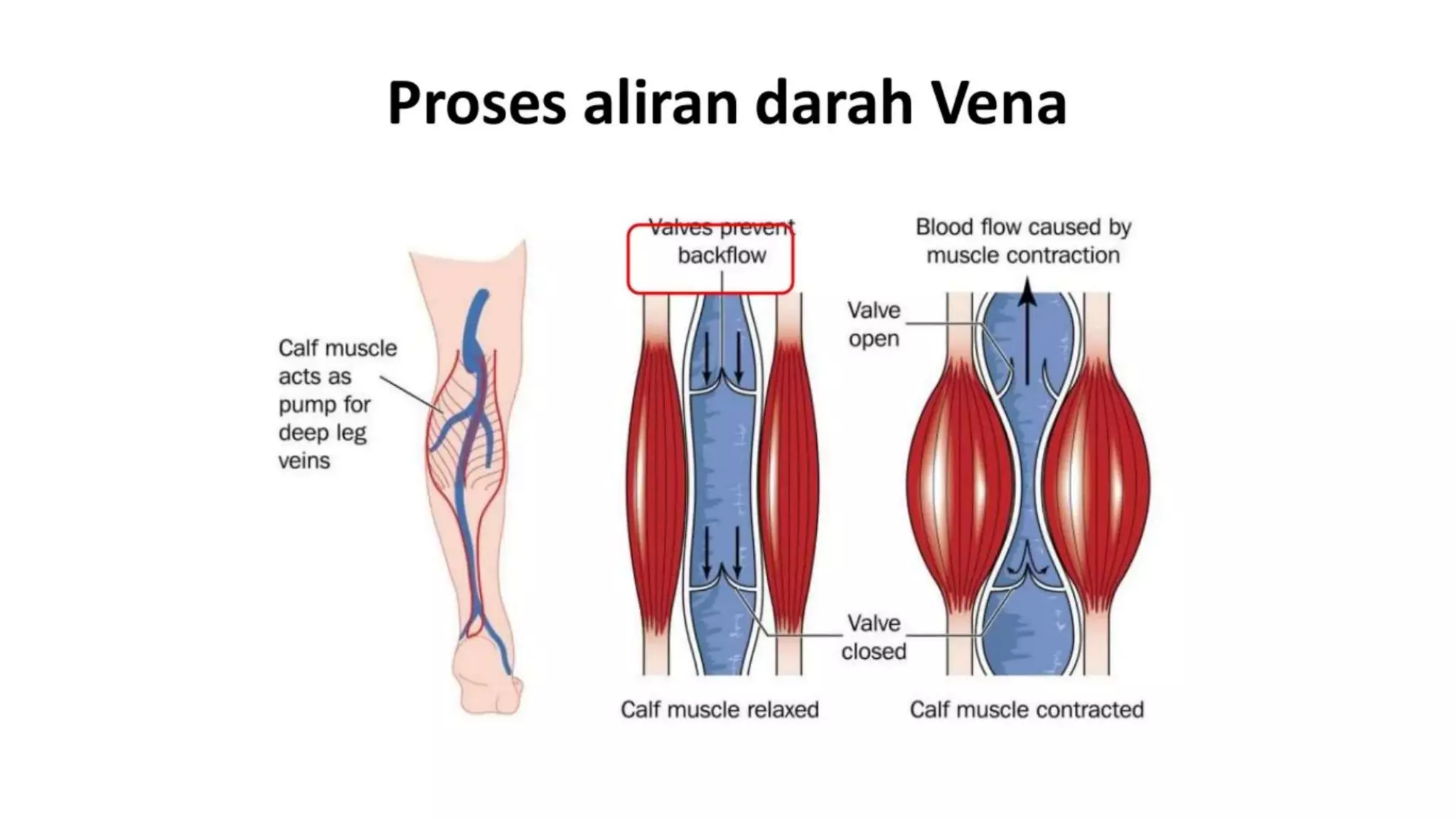 TROMBOSIS VENA DALAM DAN VARISES VENA DALAM.pptx | Blood Disorders ...