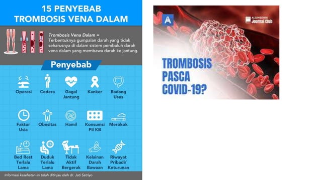 TROMBOSIS VENA DALAM DAN VARISES VENA DALAM.pptx | Blood Disorders ...