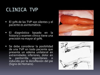 Trombosis venosa | PPTX