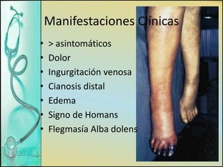 Trombosis venosa profunda | PPTX
