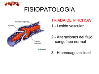 Trombosis venosa profunda | PPT