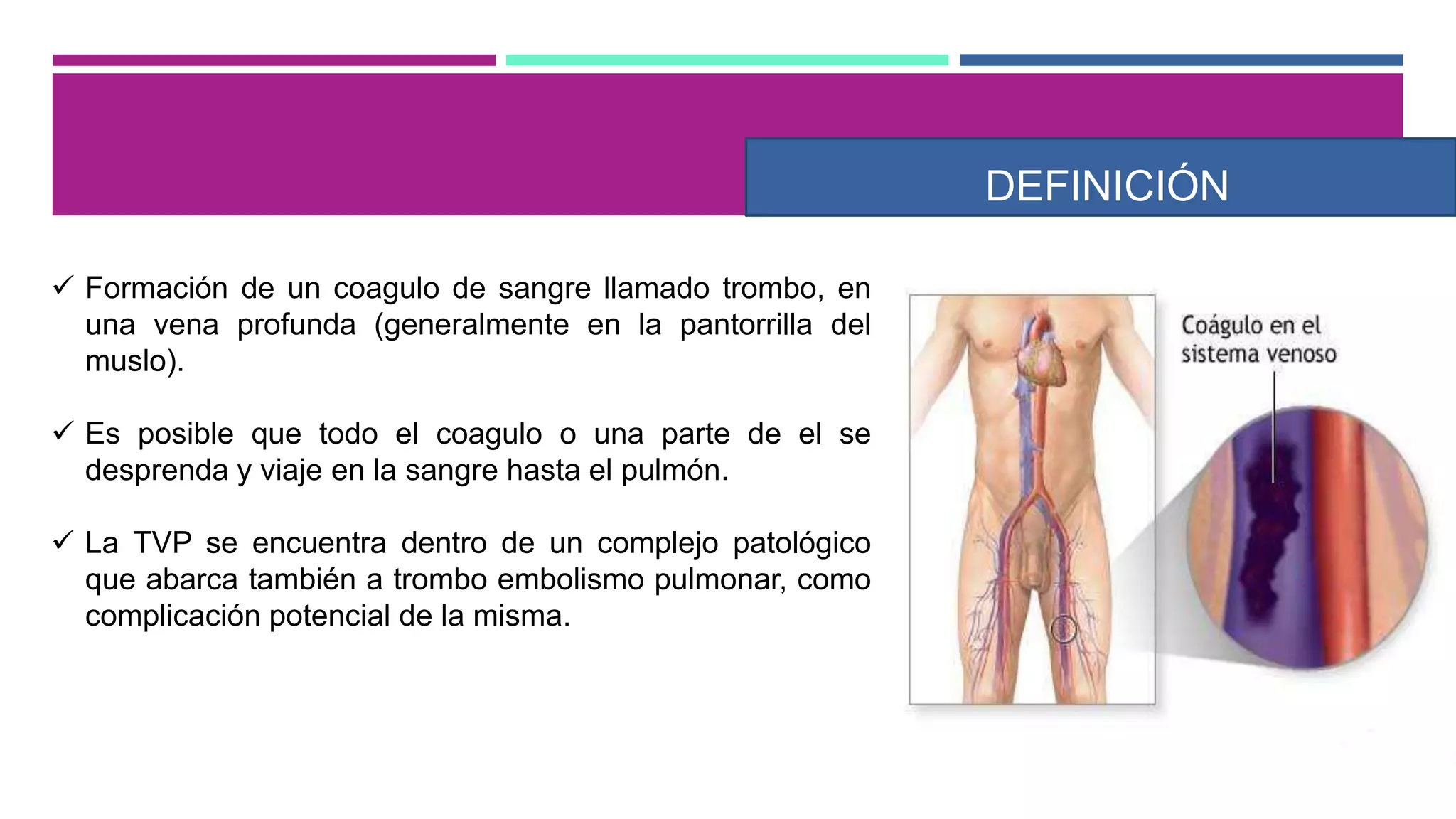 Trombosis venosa profunda | PPTX