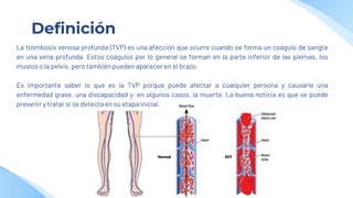 Trombosis Venosa Profunda | PPTX