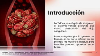 TROMBOSIS VENOSA PROFUNDA.pptx