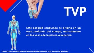 Trombosis venosa profunda.pptx