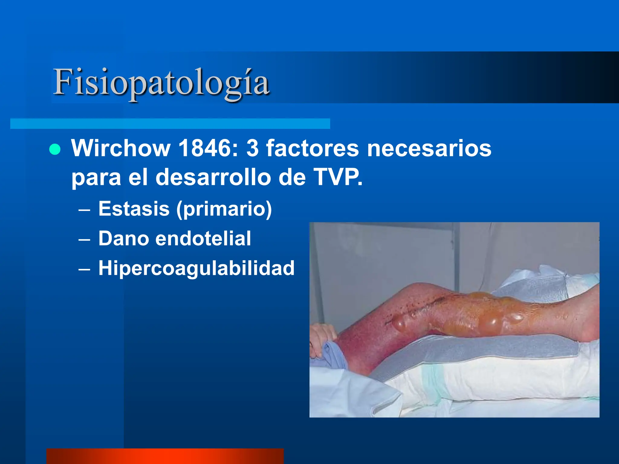 PRESENTACION DE TROMBOSIS VENOSA PROFUNDA | PPT