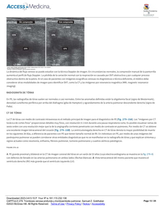 Trombosis venosa profunda y tromboembolia pulmonar. Harrison ...