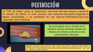 Trombosis venosa profunda-Cirugía vascular.pptx