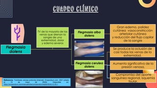 Trombosis venosa profunda-Cirugía vascular.pptx