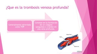 Trombosis venosa profunda (TVP) | PPTX
