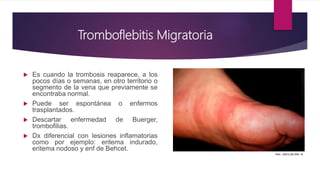 Trombosis venosa Superficial | PPTX