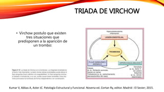Trombosis y embolia | PPTX
