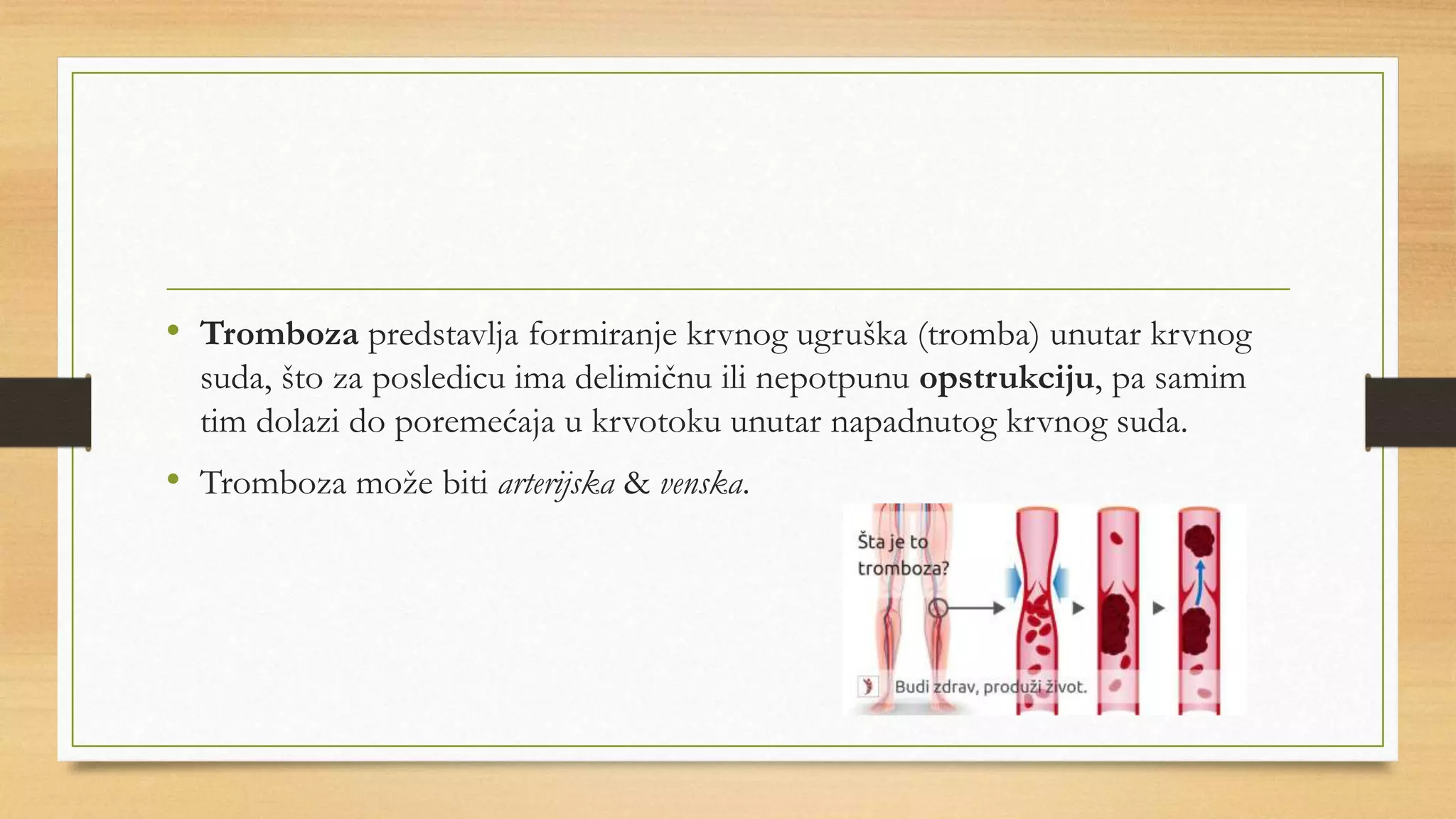 Tromboza & Embolija | PPTX