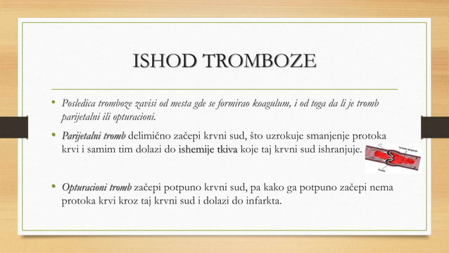 Tromboza & Embolija | PPTX