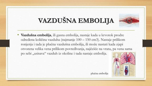 Tromboza & Embolija | PPTX