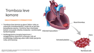 Tromb u srcu.pptx