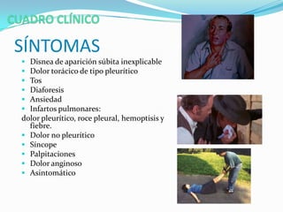 Tromboembolia pulmonar | PPTX