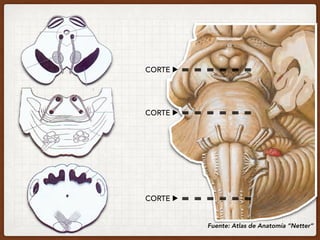 Configuración Interna de Tronco Encefálico | PPT