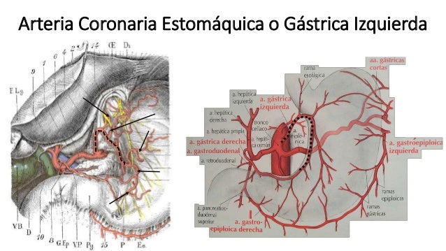 Anatomía - Tronco celíaco (Triangulos, Colaterales y Terminales)