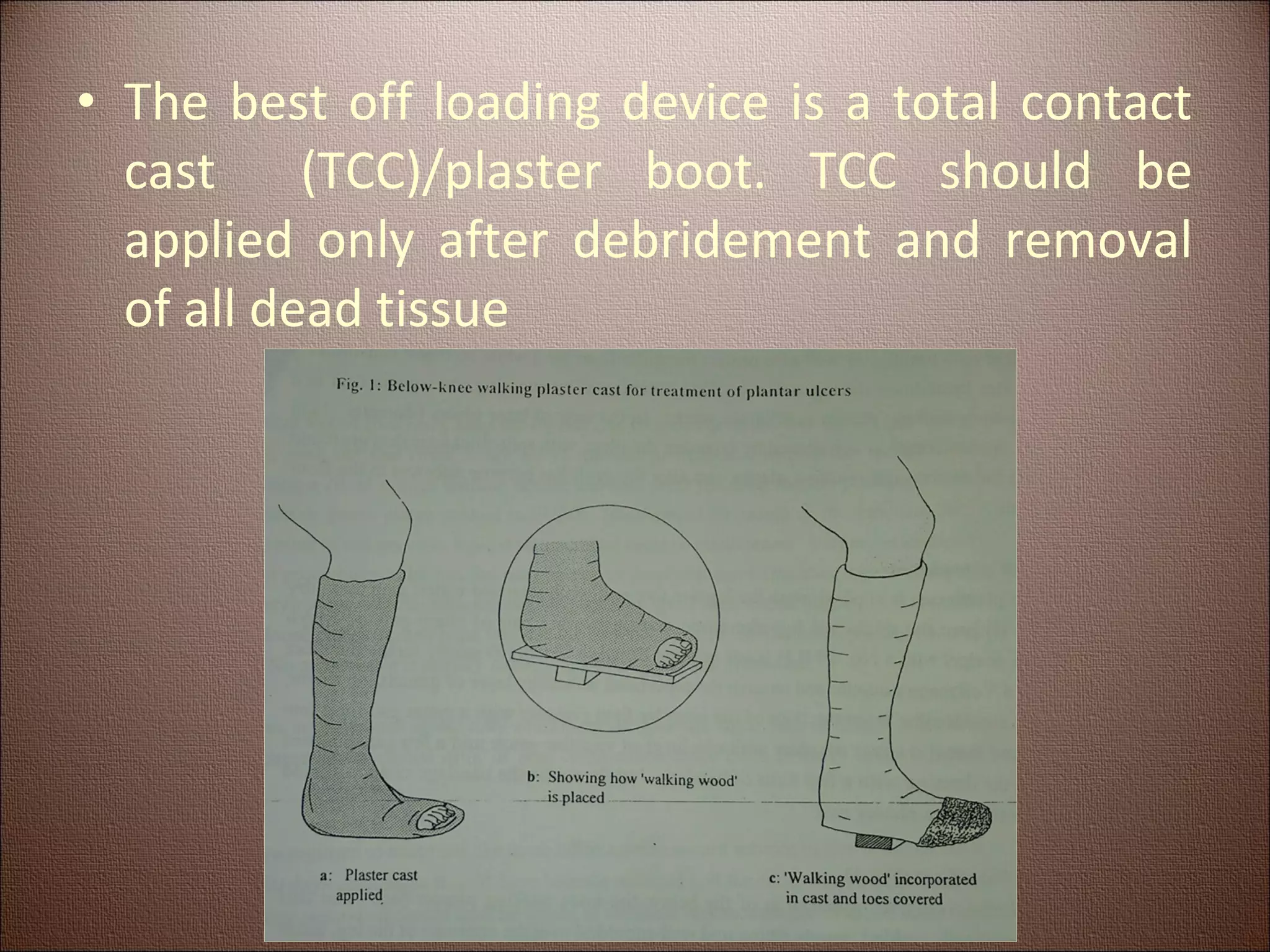 Trophic ulcers | PPT