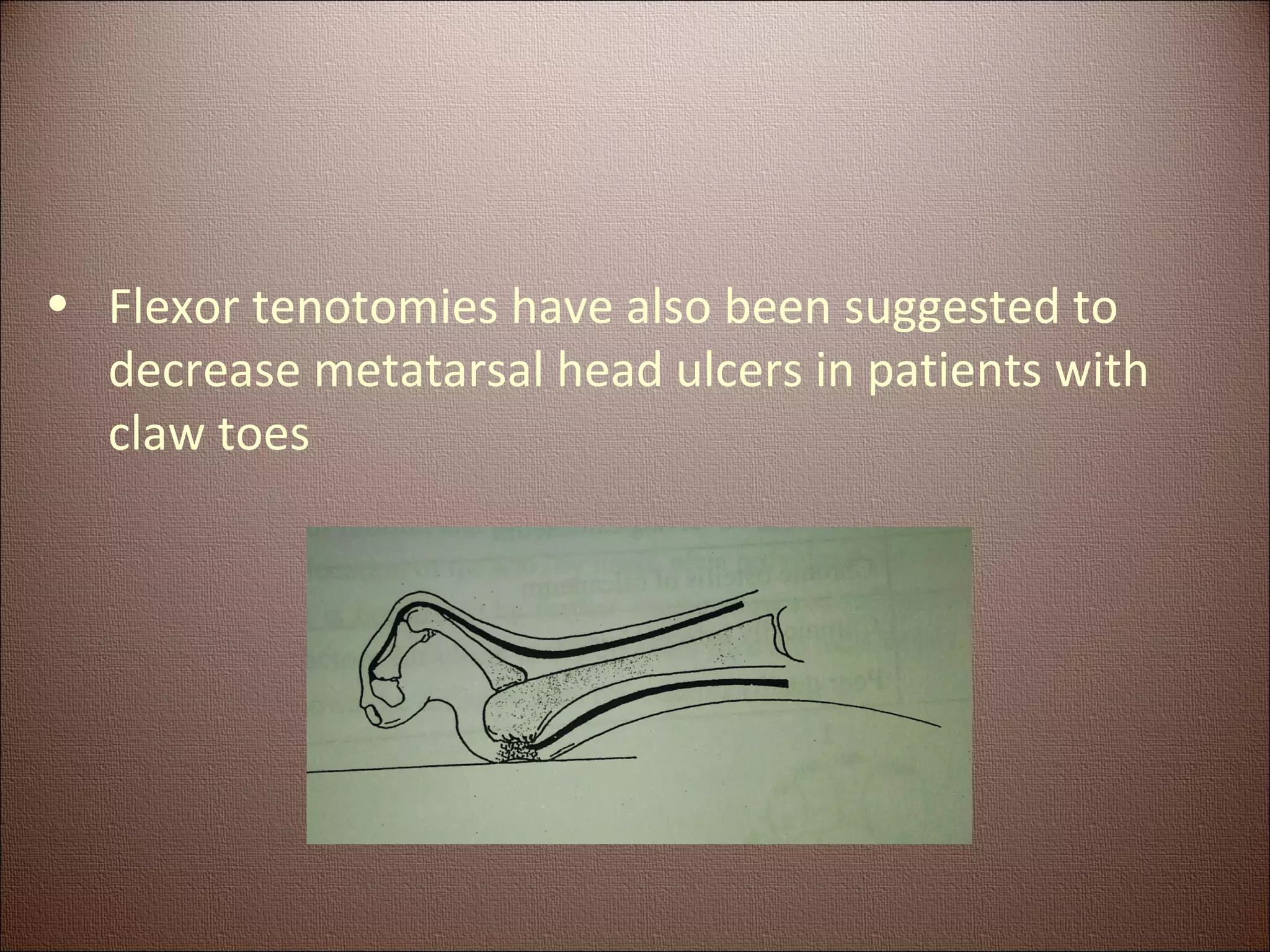 Trophic ulcers | PPT