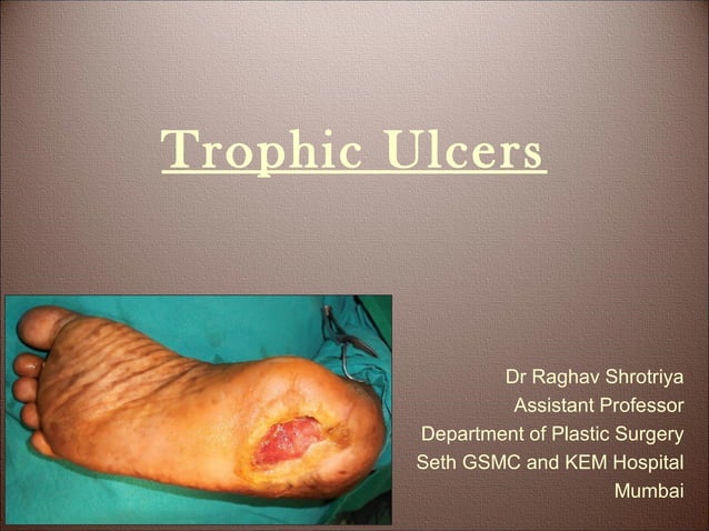 Trophic ulcers | PPT | Foot Health | Diseases and Conditions