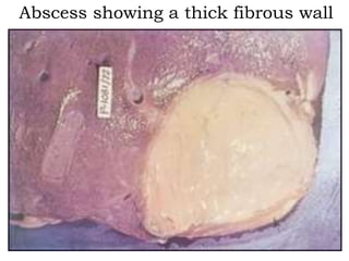 Tropical disease | PPTX