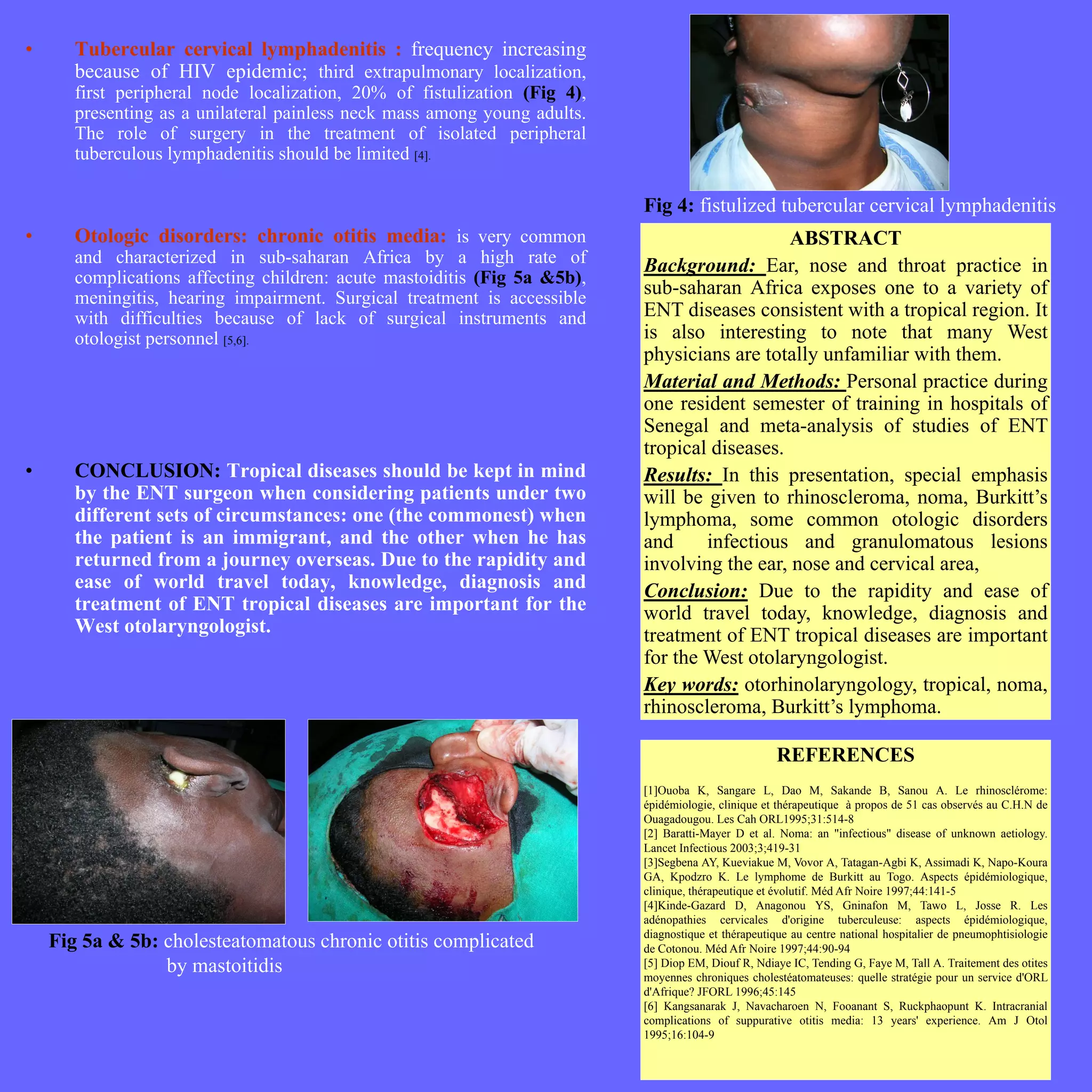 Tropical ENT MD thesis | PPT