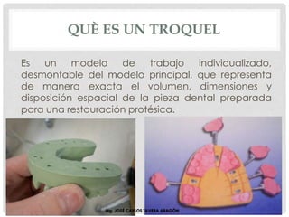 Troquelado en Prótesis Fija: Técnica de laboratorio | PPTX