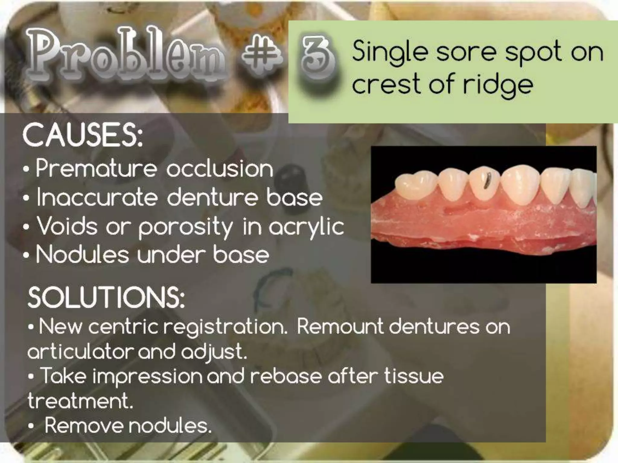 Troubleshooting fpd, rpd and cd | PPT