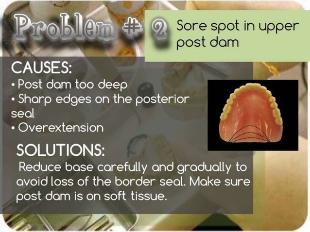 Troubleshooting fpd, rpd and cd | PPT