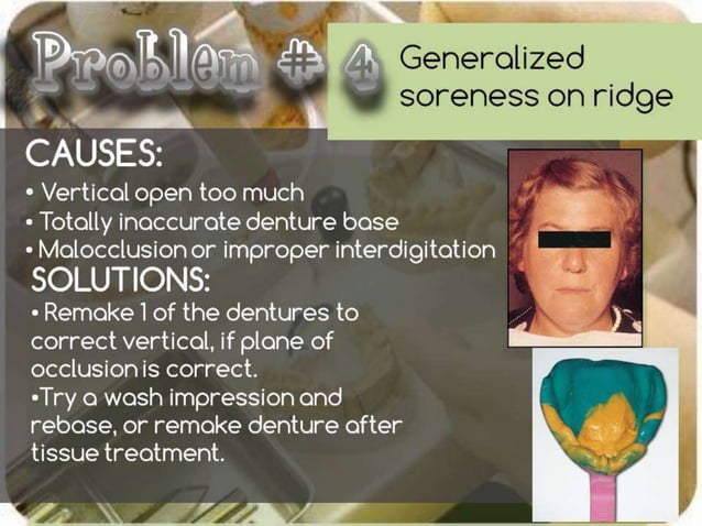 Troubleshooting fpd, rpd and cd | PPT