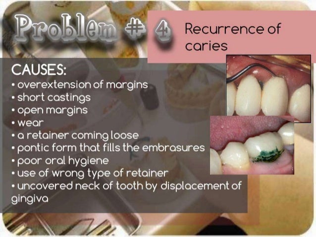 Troubleshooting fpd, rpd and cd