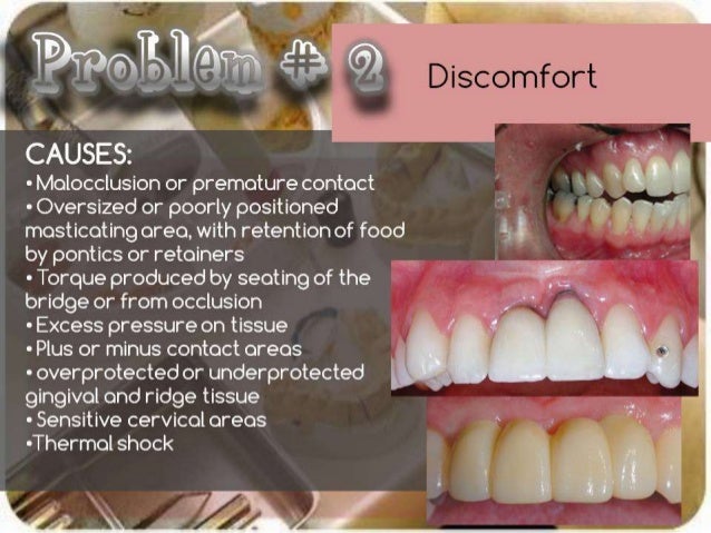 Troubleshooting fpd, rpd and cd